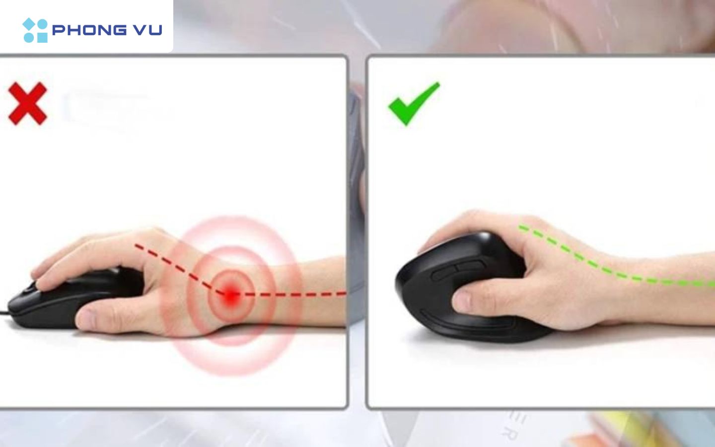 Chuột Công Thái Học Là Gì? Top 3 Chuột Công Thái Học Nên Mua